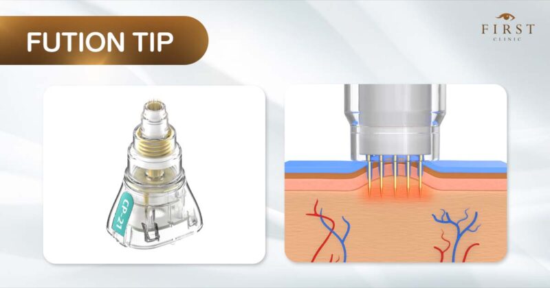 Potenza - First Clinic
