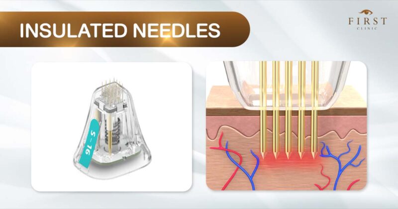 Potenza - First Clinic