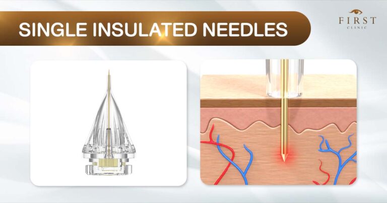 Potenza - First Clinic